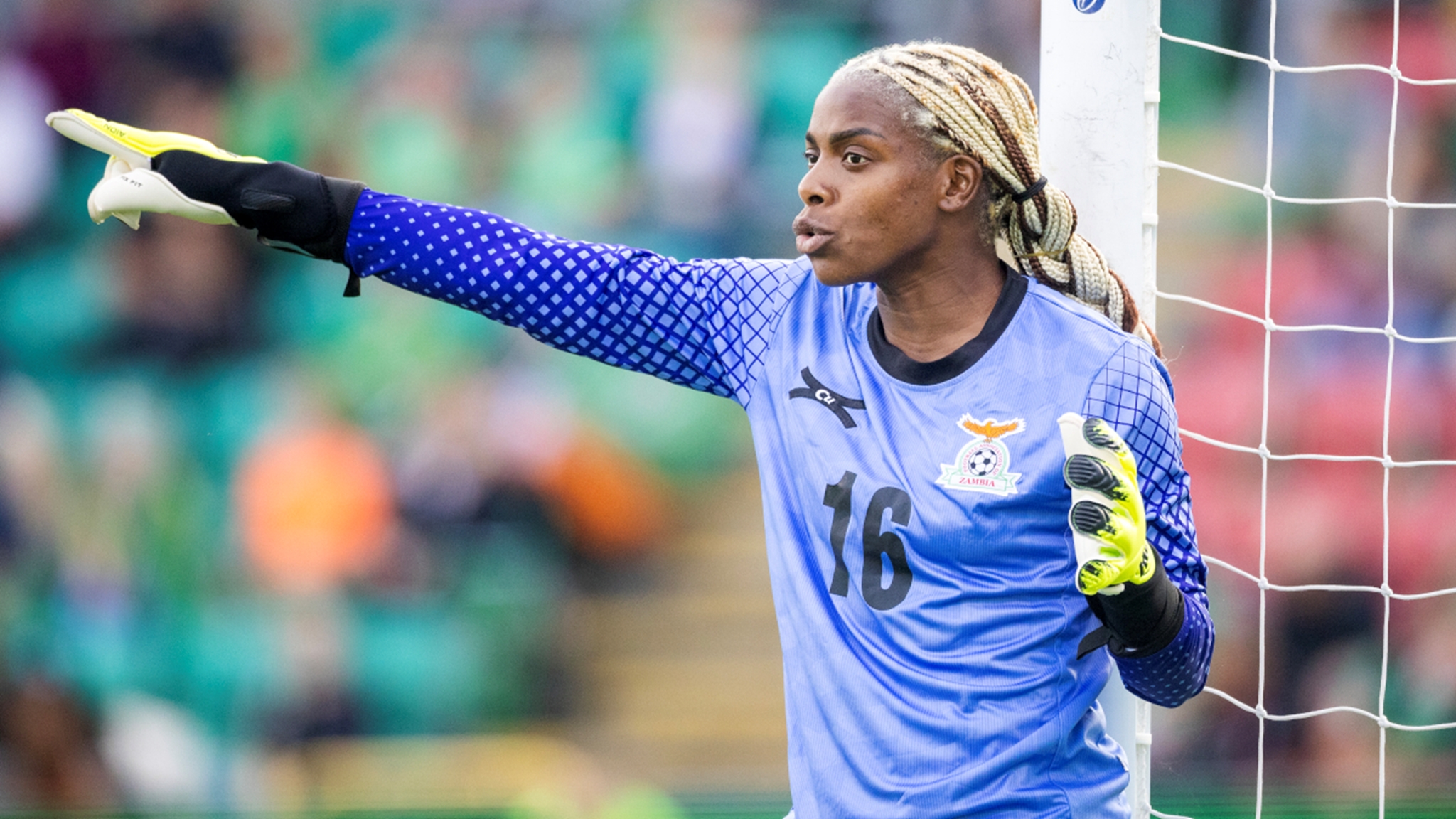 Nali’s surgery a success – Surgeon – Zambia: News Diggers!